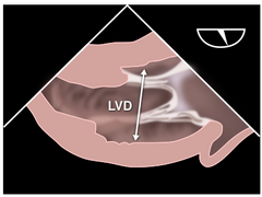 Normal Values of TEE - Echopedia
