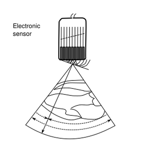 The principle of ultrasound - Echopedia