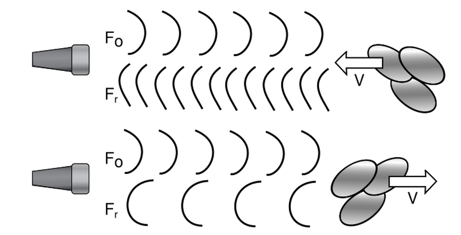 The principle of ultrasound - Echopedia