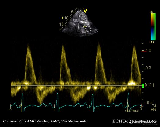 Case 18 - Echopedia