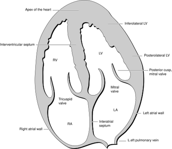 Apical 4 chamber - Echopedia