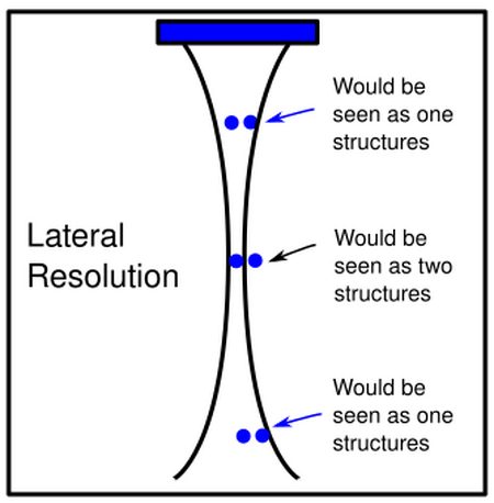 The principle of ultrasound - Echopedia