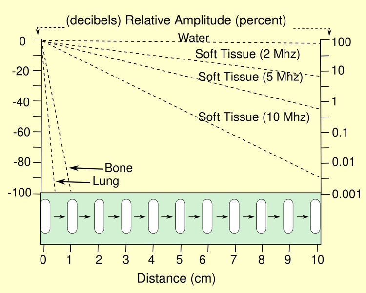The principle of ultrasound - Echopedia