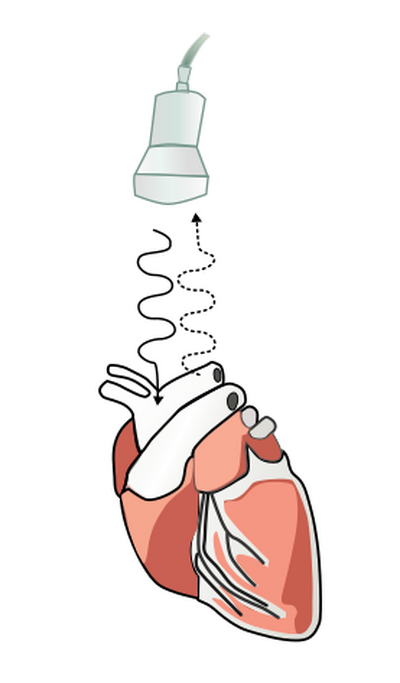 The principle of ultrasound - Echopedia