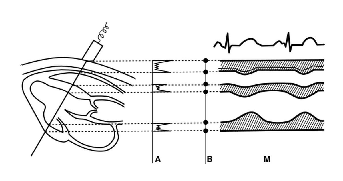 The principle of ultrasound - Echopedia