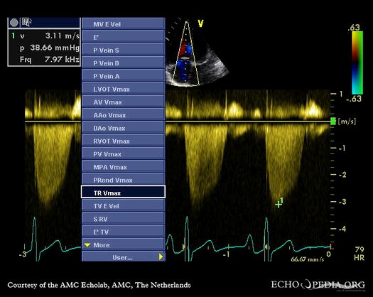Case 109 - Echopedia