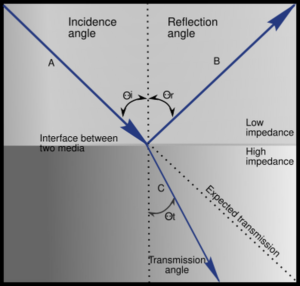 The principle of ultrasound - Echopedia