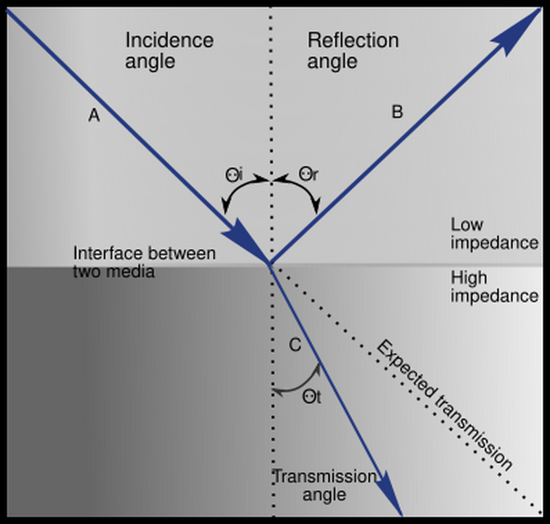 The principle of ultrasound - Echopedia