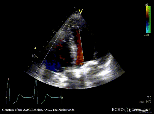 Case 156 - Echopedia
