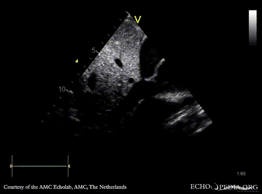 Case 123 - Echopedia