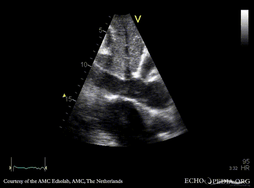 Case 122 - Echopedia