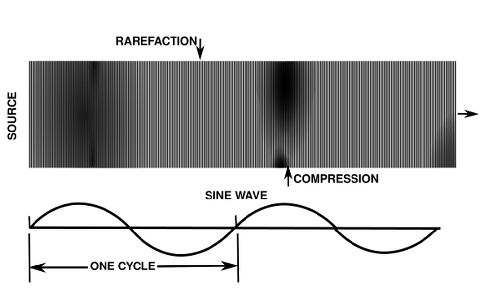 The principle of ultrasound - Echopedia