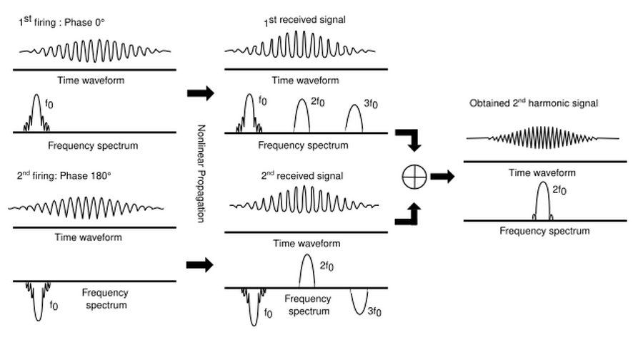 The principle of ultrasound - Echopedia
