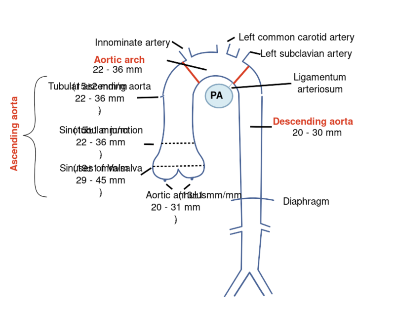 Aorta - Echopedia