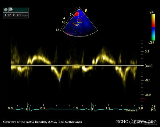Case 129 - Echopedia