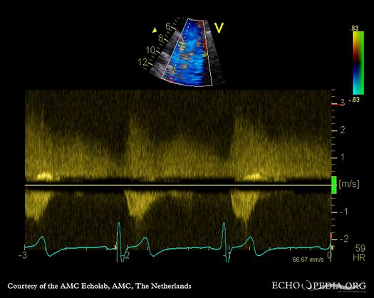 Case 114 - Echopedia