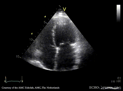 Case 129 - Echopedia