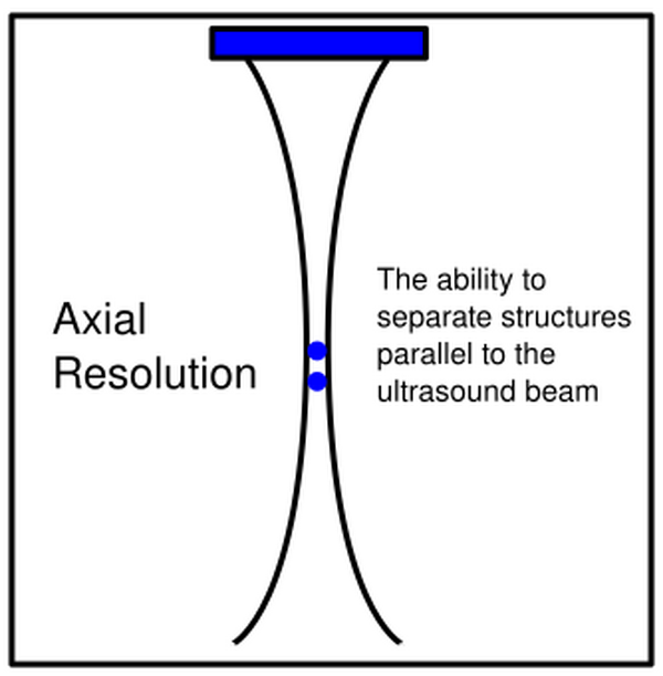 The principle of ultrasound - Echopedia