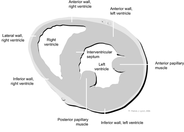 Parasternal short axis - Echopedia
