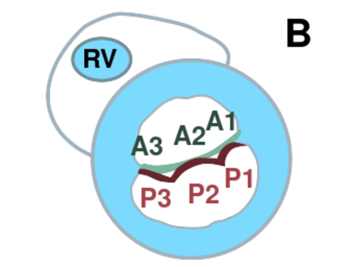 File:MV PSAX.svg - Echopedia