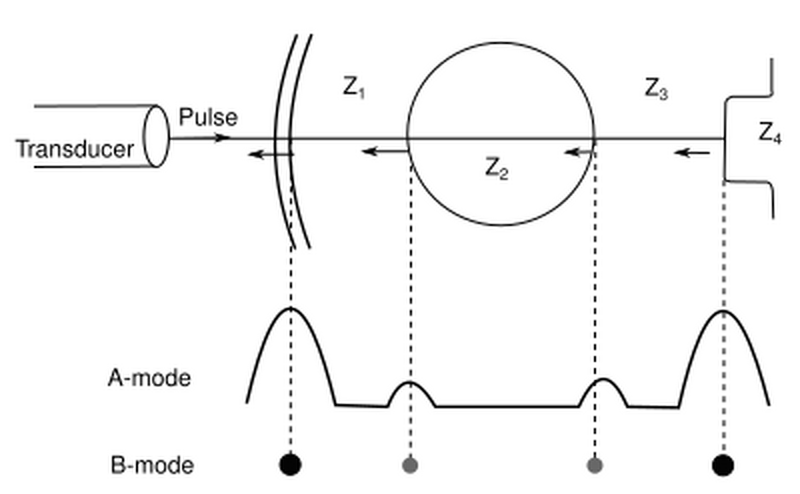 The principle of ultrasound - Echopedia